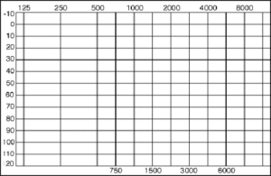 Blank Audiogram Template Download (1) - TEMPLATES EXAMPLE | TEMPLATES ...