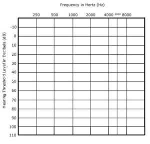 Blank Audiogram Template Download - TEMPLATES EXAMPLE | TEMPLATES EXAMPLE