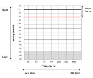 Blank Audiogram Template Download (2) - TEMPLATES EXAMPLE | TEMPLATES ...