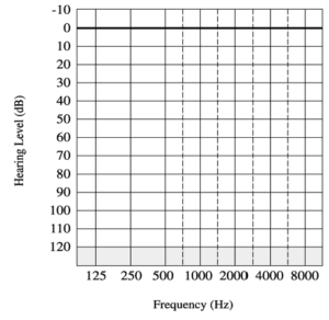 Blank Audiogram Template Download - TEMPLATES EXAMPLE | TEMPLATES EXAMPLE